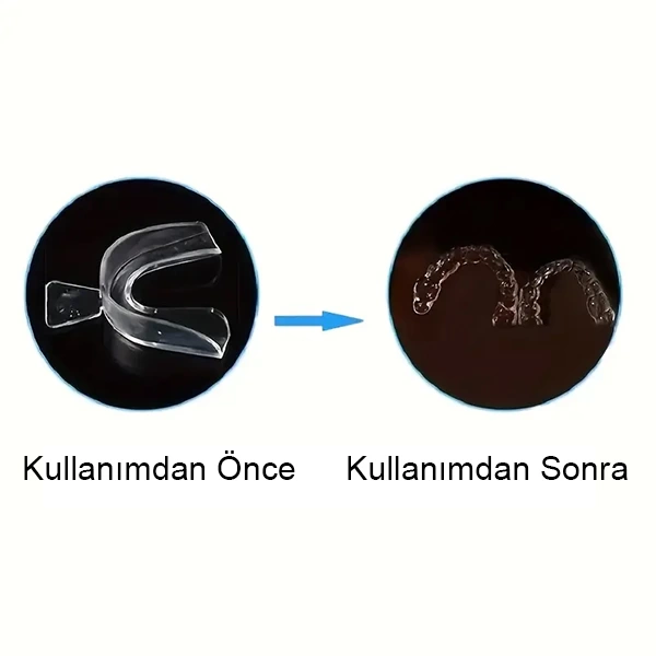 Diş Gıcırdatma Diş Sıkma Çene Sıkma Önleyici Silikon Gece Plağı